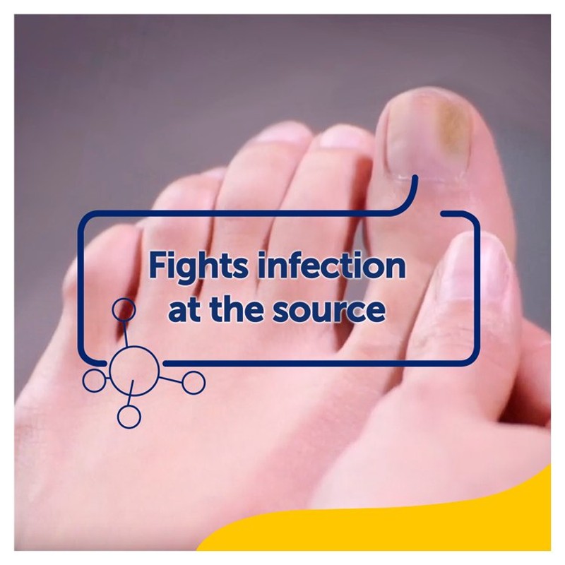 Scholl Fungal Nail Treatment Kit - Morrisons Online Groceries & Offers