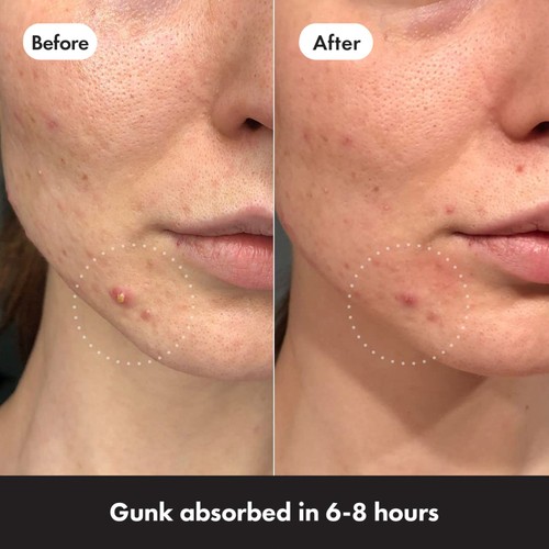 Hero Mighty Patch Original - Morrisons Online Groceries & Offers